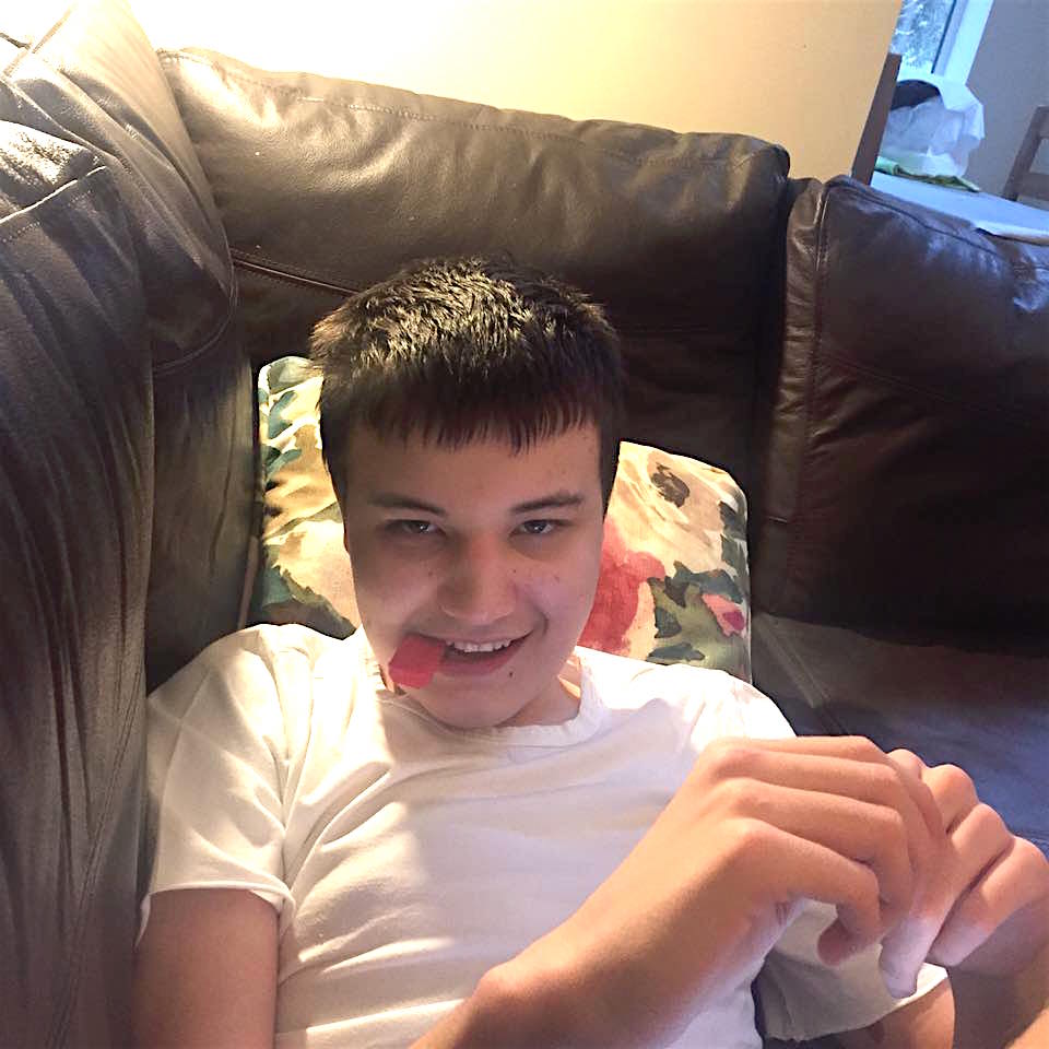 Autism, Epilepsy, And The One-In-Three Chance Of Both – The Additional ...